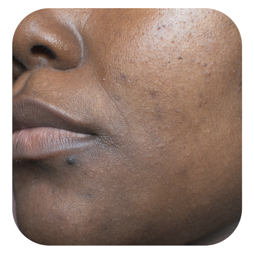 Gin Amber Beauty: Best Dermarollers for Skin, Face, Scalp