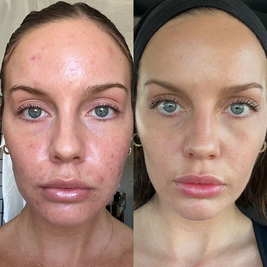 Hydration Kit - Sensitive, Dry Skin – Gin Amber Beauty