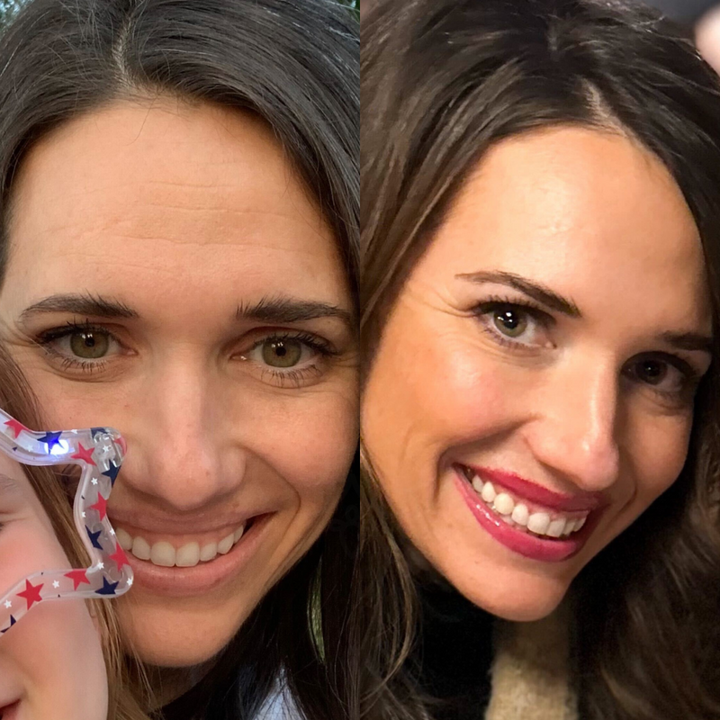 12 in 1 Anti-Aging Bundle – Gin Amber Beauty